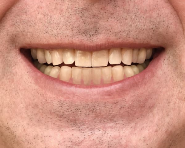 Fairfax Dentist — District Dental Group — Fairfax, VA